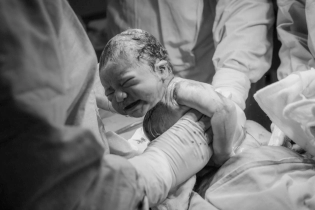 Signs of Birth Injuries and Legal Options in Indianapolis